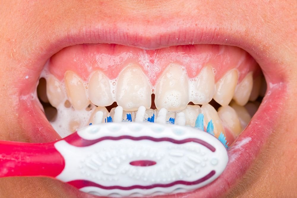 Igiene e Prevenzione Dentale | Studio Dentistico Bilello Dr. Alberto
